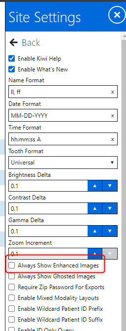Location Specific Filters (XVWeb) – Apteryx