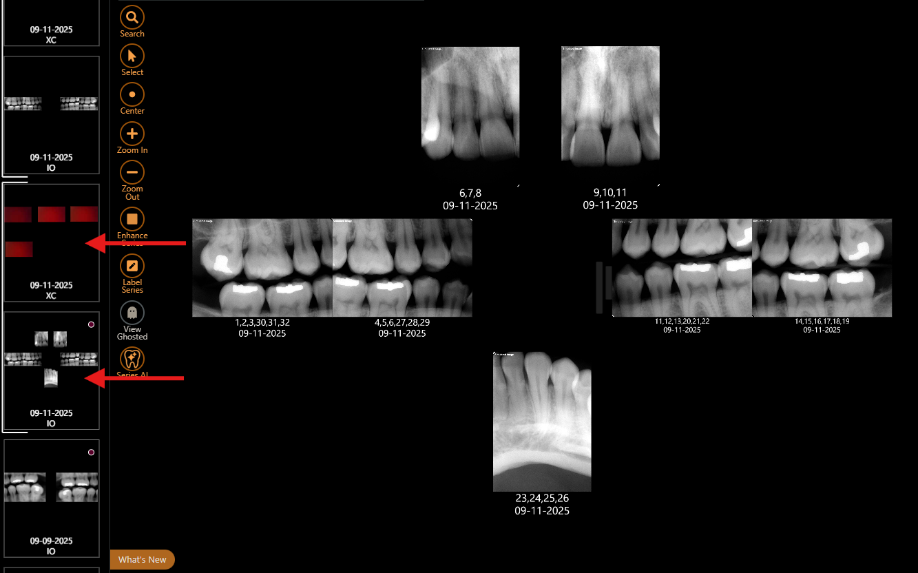 Site Setting - Mixed Modality – Apteryx