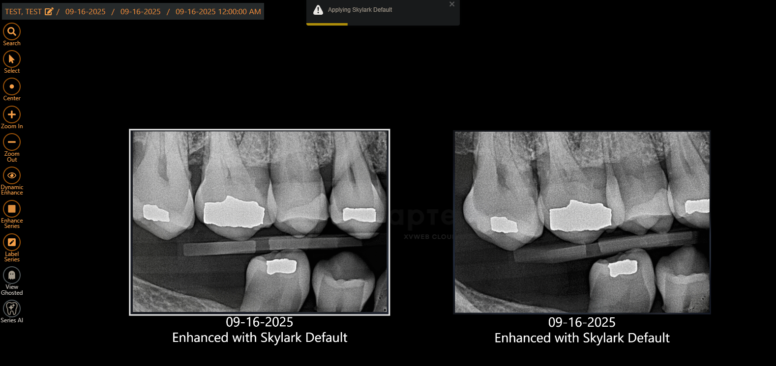 Image Quality - Enhancement Types in XVWeb – Apteryx
