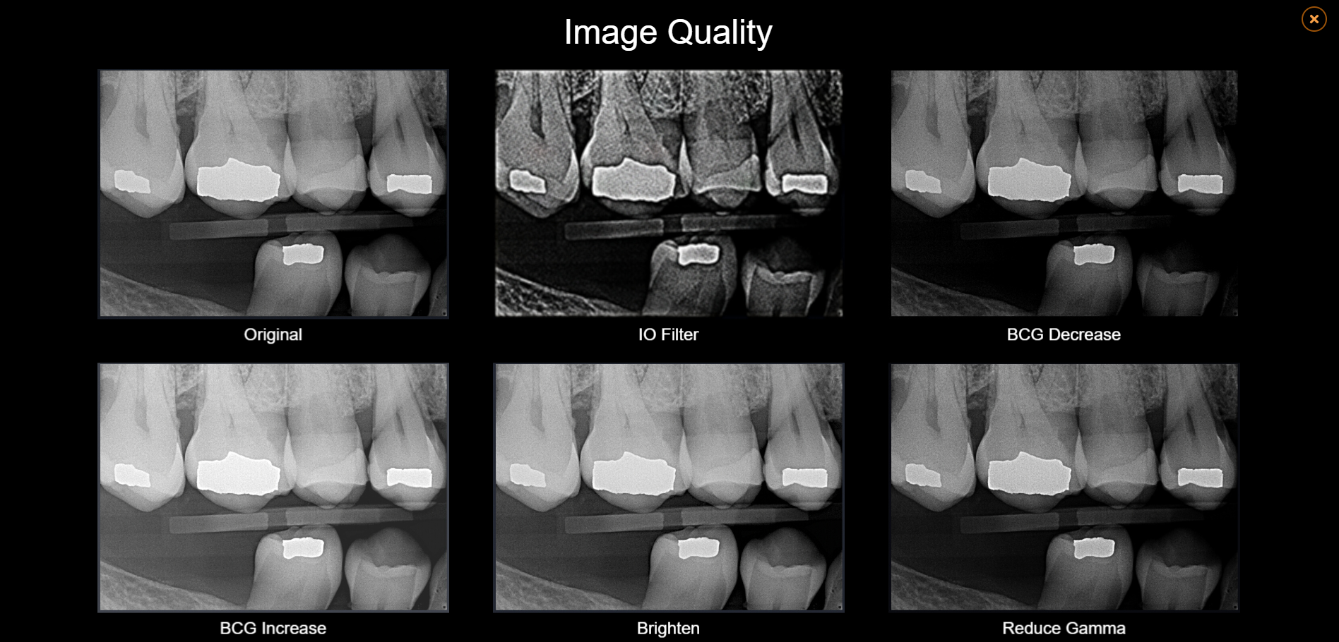 Image Quality - Enhancement Types in XVWeb – Apteryx