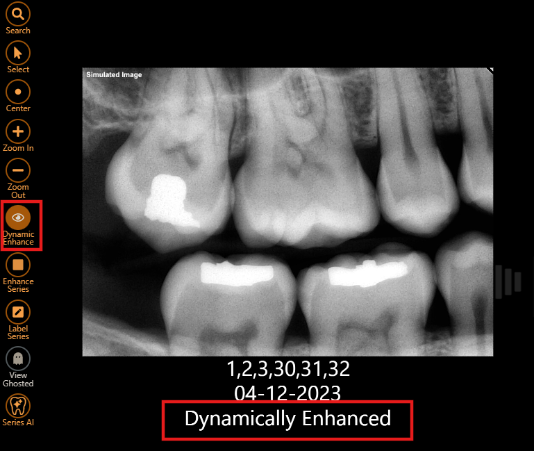 Image Quality - Enhancement Types in XVWeb – Apteryx