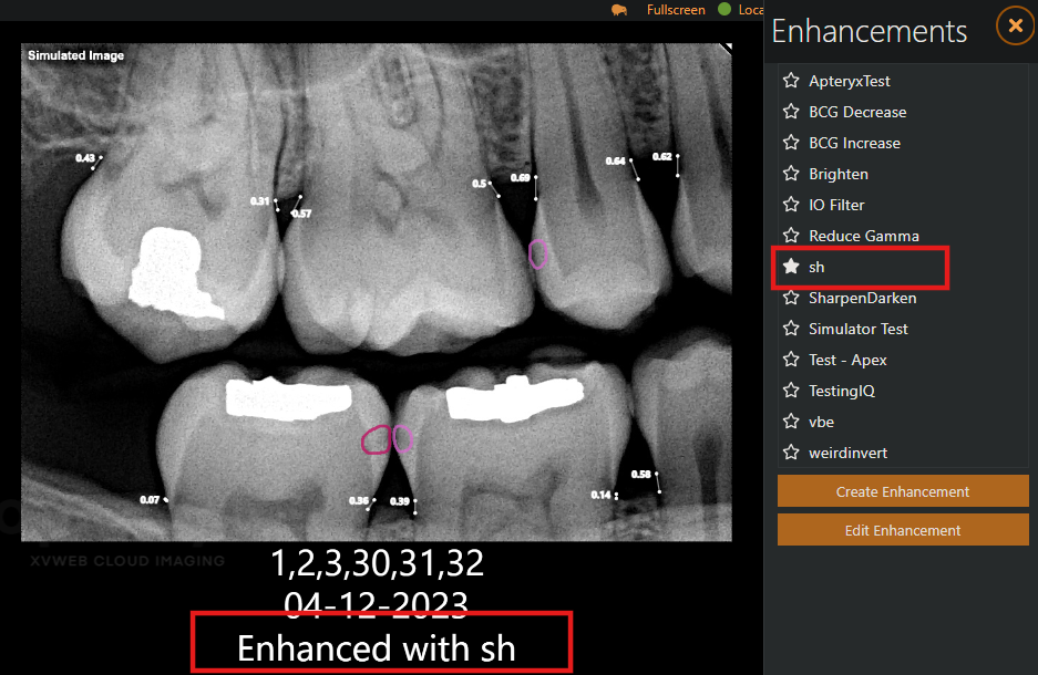 Image Quality - Enhancement Types in XVWeb – Apteryx